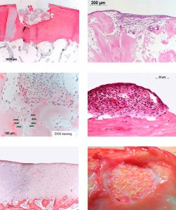 Knorpelregeneration | Praxis für Orthopädie und Unfallchirurgie